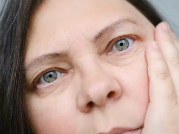 How Blepharoplasty Can Improve Uneven Eyelids