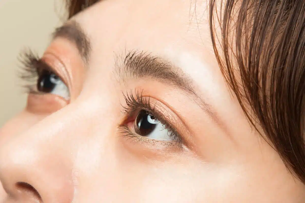 Understanding Mini Brow Lifts: Everything You Need to Know