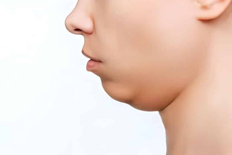 How to Determine the Ideal Chin Implant Shape for Your Facial Aesthetics