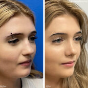 Daniel G. Becker MD, FACS | Becker Plastic Surgery